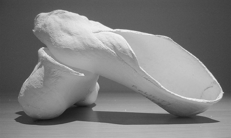 Orthotic insoles Treatment today | Yorkshire Foot HospitalYorkshire ...